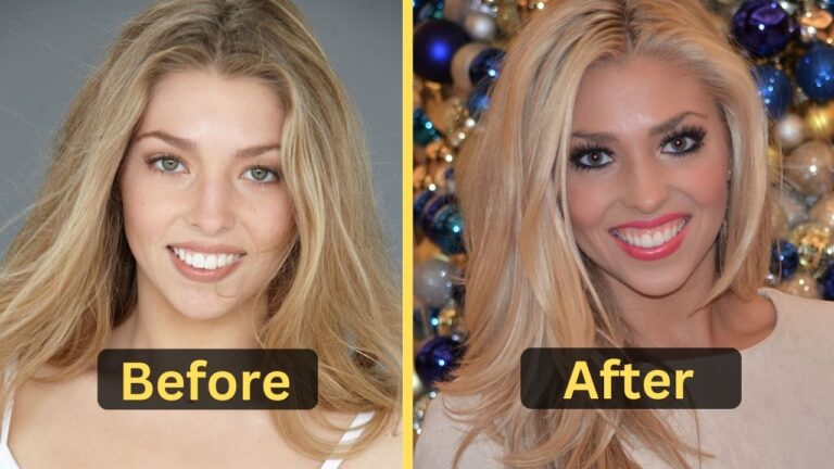 Victoria Kalina Weight Loss: Diet Plan, Workout, Surgery, Before and ...