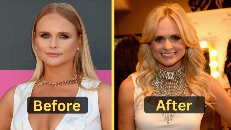 Miranda Lambert Weight Loss: Diet Plan, Workout, Surgery, Before ...